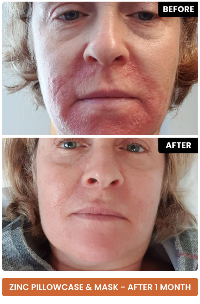 Onyx | Home page - Onyx