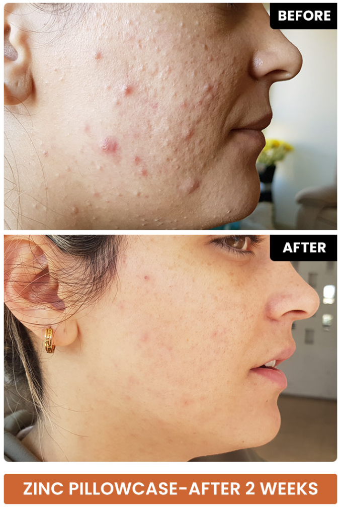 Onyx | Home page - Onyx